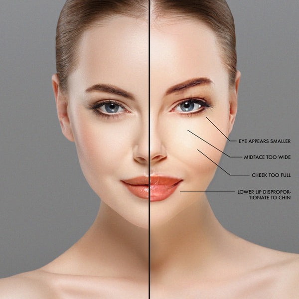 "PILLOW FACE" - LASAIR AESTHETIC HEALTH